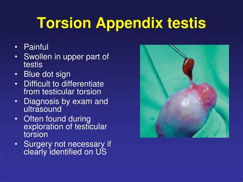 Ppt Testis Powerpoint Presentation Free Download Id 9303657