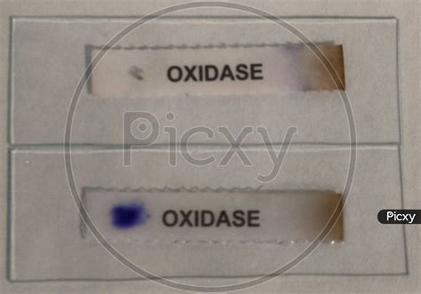 Oxidase Test Principle Procedure Result Interpretation 52 Off