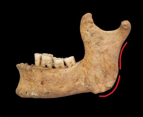 estimating sex from the skull
