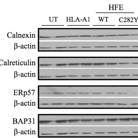 Hfe Wt Does Not Alter The Expression Of Mhc I Chaperones Involved In