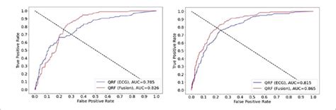 Receiver Operation Characteristic Curves For Left Hypoglycemia And