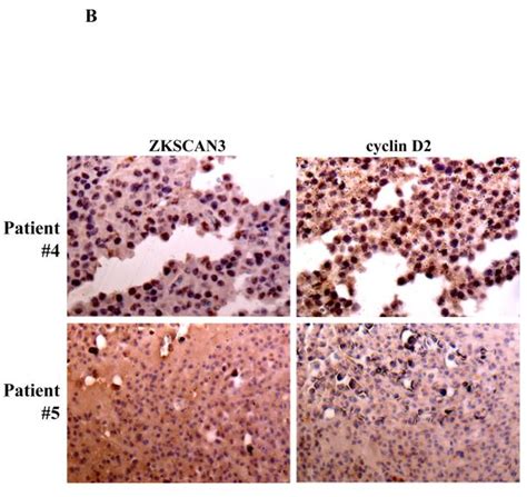 Evidence Of A Role For The Novel Zinc Finger Transcription Factor