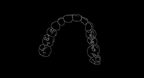 python return position and size of arbitrary teeth shapes