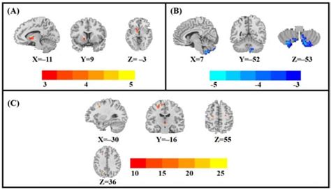 Brain Sciences Free Full Text Sex Differences Of The Functional