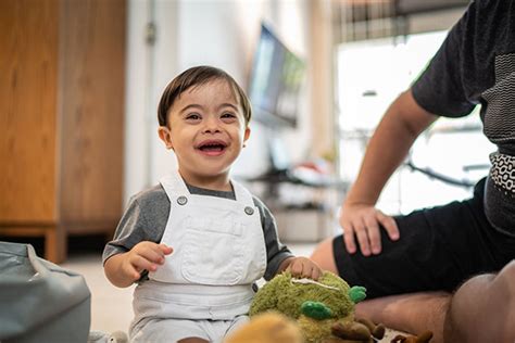 What Is Down Syndrome