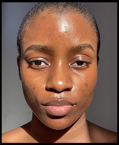 4 Acne Positive Influencers Discuss The Term Bad Skin—and Why Its