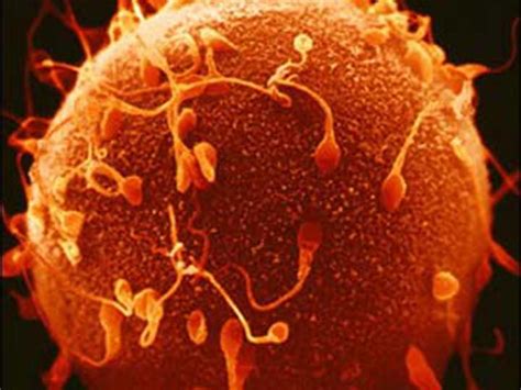 stroke rounds cell sex matters in research medpage today