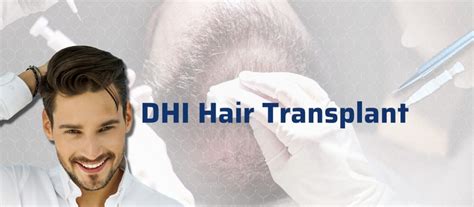 Dhi Hair Transplant Clinicexpert International Healthcare