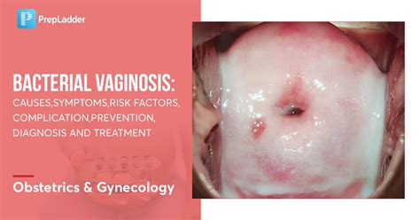 Causes And Symptoms Of Bacterial Vaginosis Ask The Nurse Expert