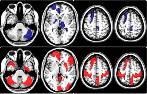 combining graph and machine learning methods to analyze differences in