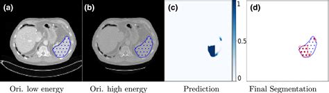Automatic Multi‐organ Segmentation In Dual‐energy Ct Dect With