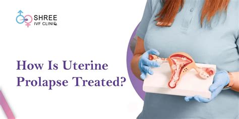 A Womans Guide To Uterine Prolapse Symptoms And Solutions