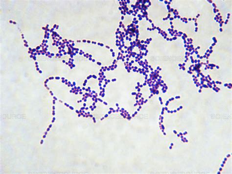 Science Source Streptococcus Pyogenes