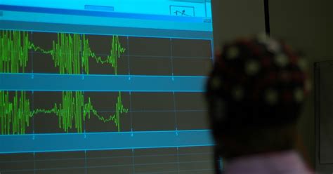 Neurofeedback Qué Es Y Cómo Se Usa Esta Herramienta Terapéutica