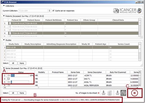 documentation nightly extensions tciabrowser slicer wiki