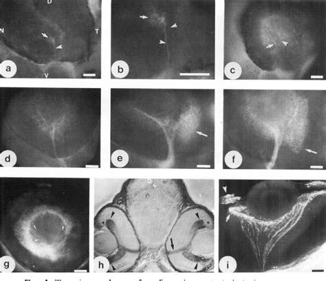 Figure 3 From Spatiotemporal Pattern Of Retinal Ganglion Cell