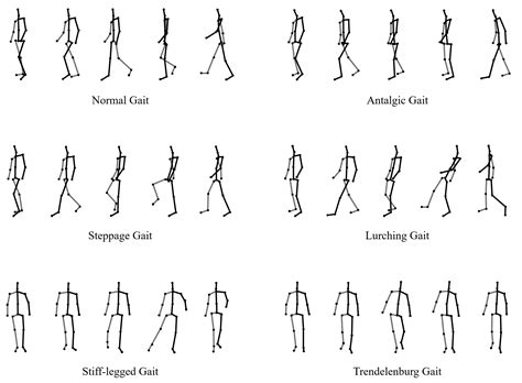Adding Pictures · Issue 2 · Kooksung Pathological Gait Datasets · Github