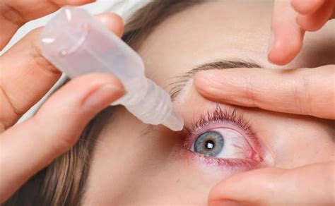 La Conjuntivitis Qué Es Síntomas Y Tratamiento