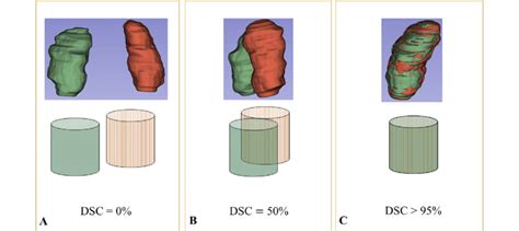 Graph Shows The Basic Principle Of Dice Similarity Coefficient Dsc