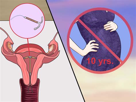 how to use emergency contraceptives 11 steps with pictures