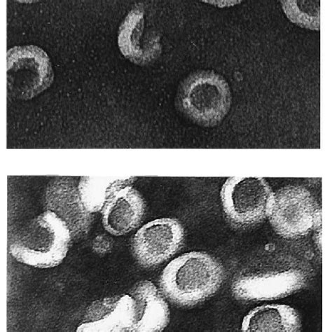 Electron Micrographs Of Sucrose Gradient Purified Negatively Stained