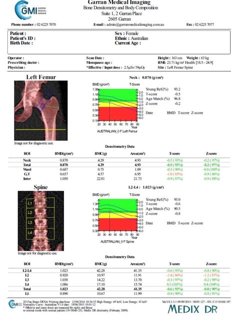 Dxa Scan Results