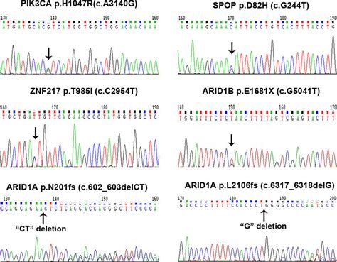 Sanger Sequencing Of Single Nucleotide Variant Snv In Fdov1