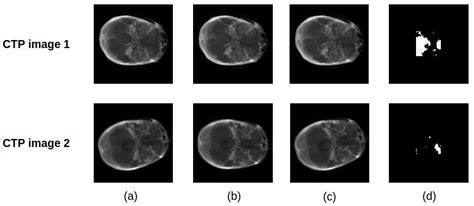 Electronics Free Full Text Ischemic Stroke Lesion Segmentation