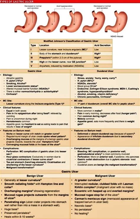 Gastric Ulcer Types