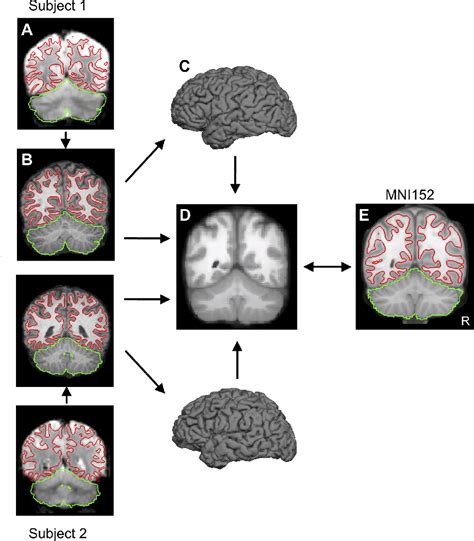 Figure 1 From The Organization Of The Human Cerebellum Estimated By