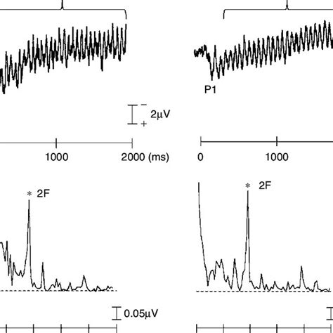 Representative Waveforms Of Veps A And Fast Fourier Transforms