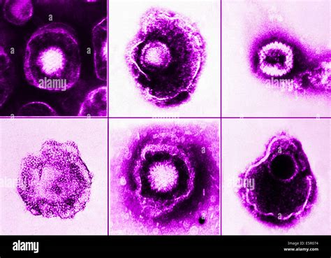 Micrografía De Electrones Del Virus Herpes Simplex Fotografía De Stock
