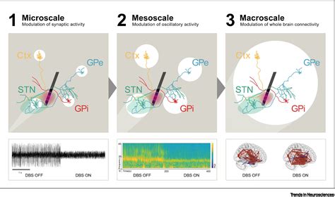 Insights And Opportunities For Deep Brain Stimulation As A Brain
