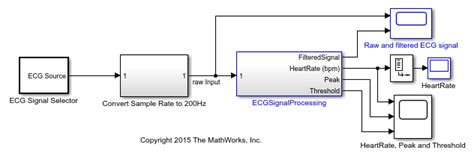 real time ecg qrs detection on arm cortex a processor matlab