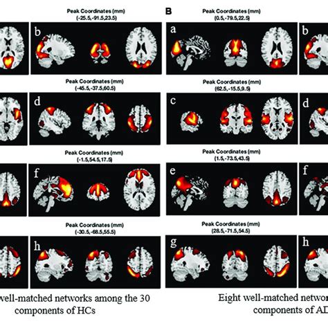 Eight Best Matched Intrinsic Connectivity Networks Icns And Their