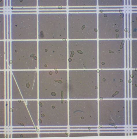 Yeast Cell Counting V2 Object Detection Dataset And Pre Trained Model