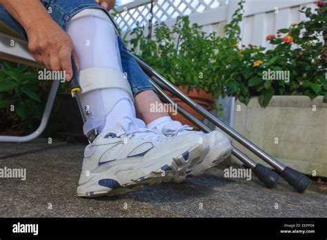 Spina Bifida Fotos Und Bildmaterial In Hoher Auflösung Alamy