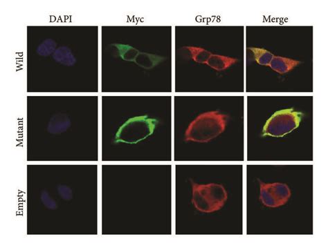 Comparison Of Processes Of Secretion Of Wild Type And Mutant Comp