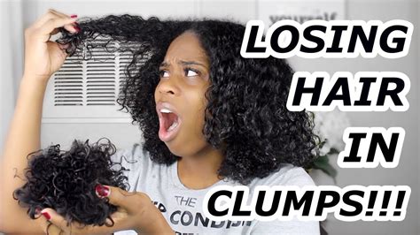 The Deep Condish Hair Falling Out In Clumps [hair Fears] Youtube