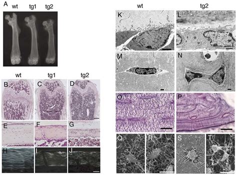 X Ray And Histological Analyses Of Sp7 Transgenic Mice A X Ray