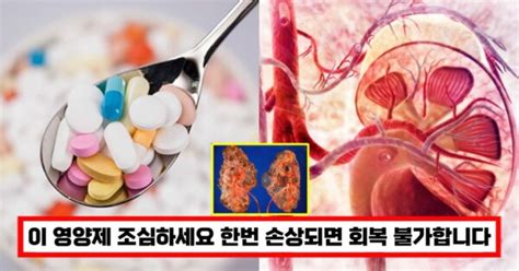 이 영양제 단 한번이라도 섭취하면 큰일납니다 약사들이 경고하는 한번만 먹어도 신장을 망가뜨리는 치명적인 성분 미디어투데이