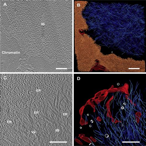 In Situ Architecture And Cellular Interactions Of Polyq Inclusions Cell