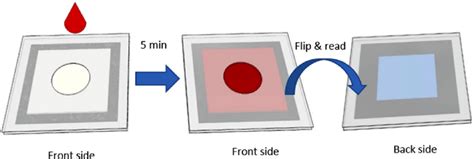 The Schematic Diagram Of The Colorimetric Detection Procedure Using The