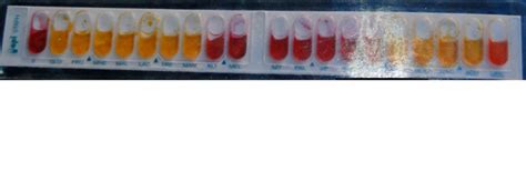 25 Api Staph Test Results Download Scientific Diagram