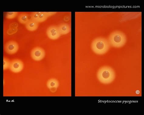 Morphology Of Streptococcus Pyogenes