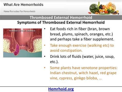 Thrombosed External Hemorrhoid