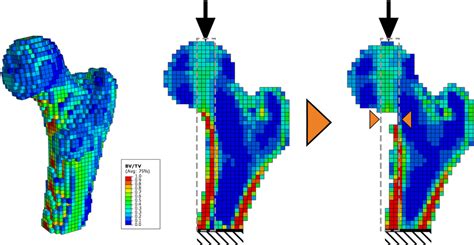 Qct Based Finite Element Model With A Voxel Size Of 3 Mm × 3 Mm × 3 Mm