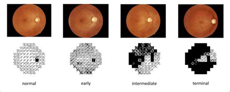 Figure 2 From A Multimodal Classification Architecture For The Severity
