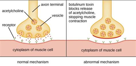 Clostridium Botulinum Properties Pathogenesis Lab Diagnosis