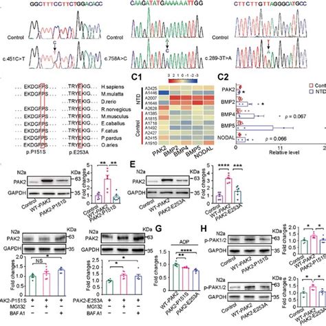 Clinical Characteristics Of Pak2 Rare Variants In Human Ntd Cases